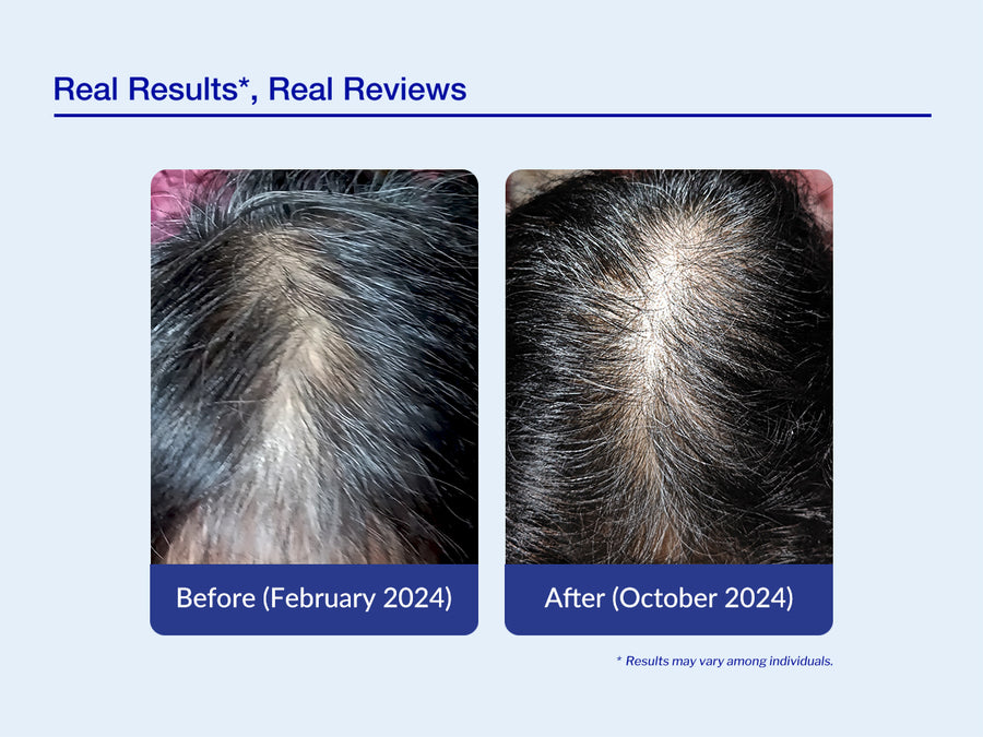 CosmeRNA Revitalizing Hair Follicle Tonic 2ml – CosmernaUS