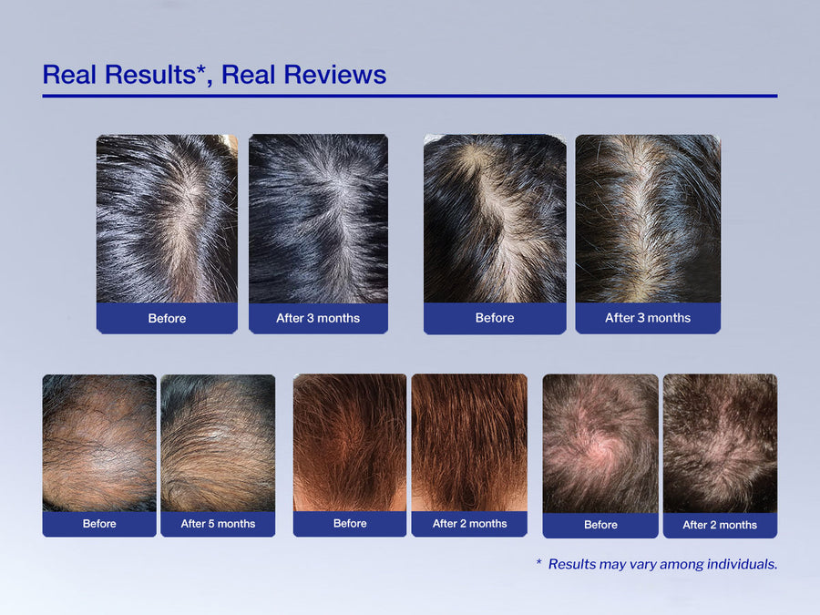 CosmeRNA Revitalizing Hair Follicle Tonic 2ml – CosmernaUS